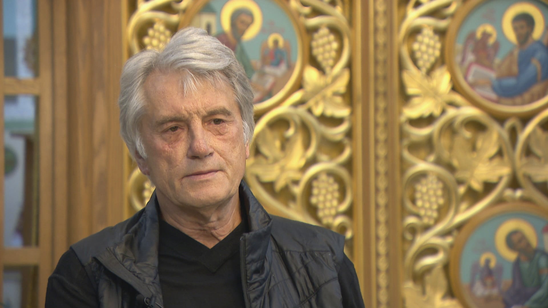 Viktor Yushchenko Before And After Poisoning